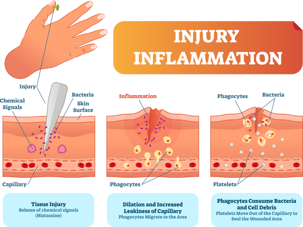 ¿Conoces la inflamación y su patologías en el cuerpo? - Centro Indigo